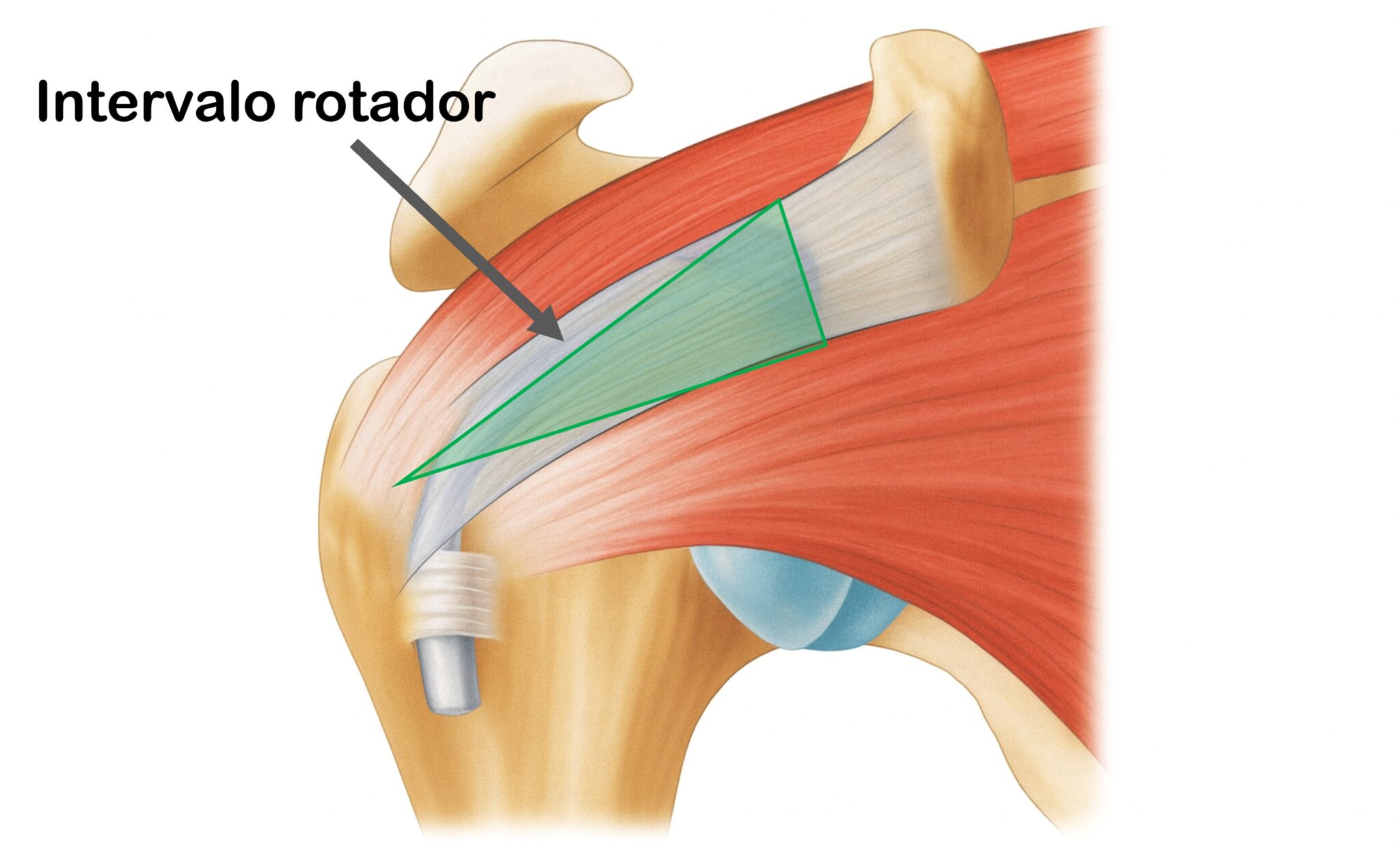 Hombro: Clasificación de las lesiones SLAP – Médicos Radiólogos